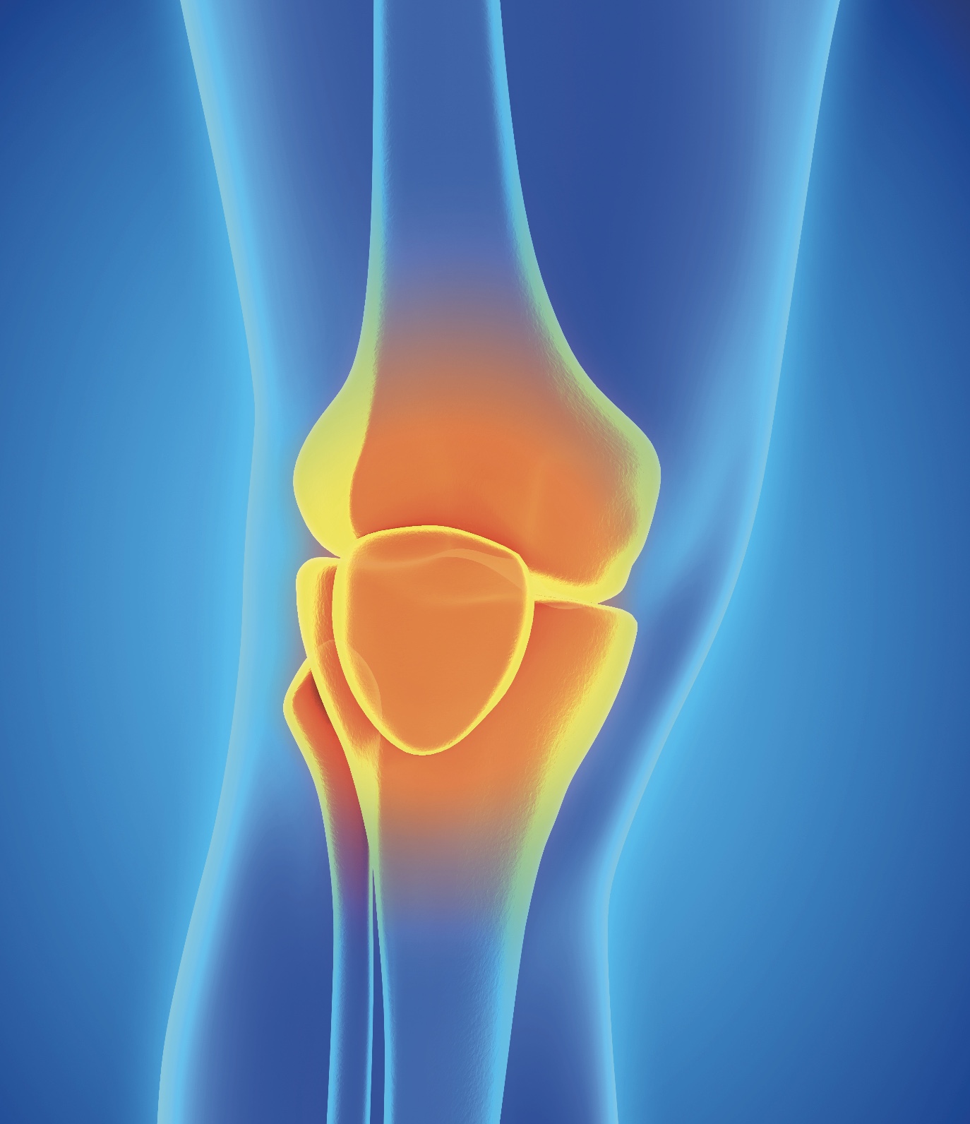 Knie - Ihre Prothese